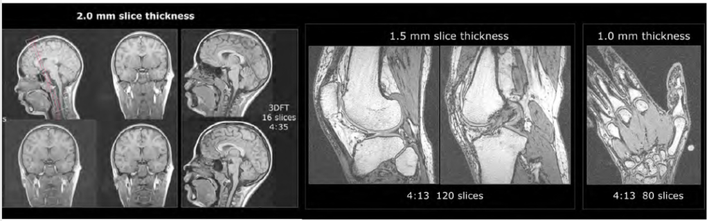 Misunderstanding Field Strength – Washington Open MRI