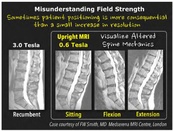 Misunderstanding Field Strength – Washington Open MRI