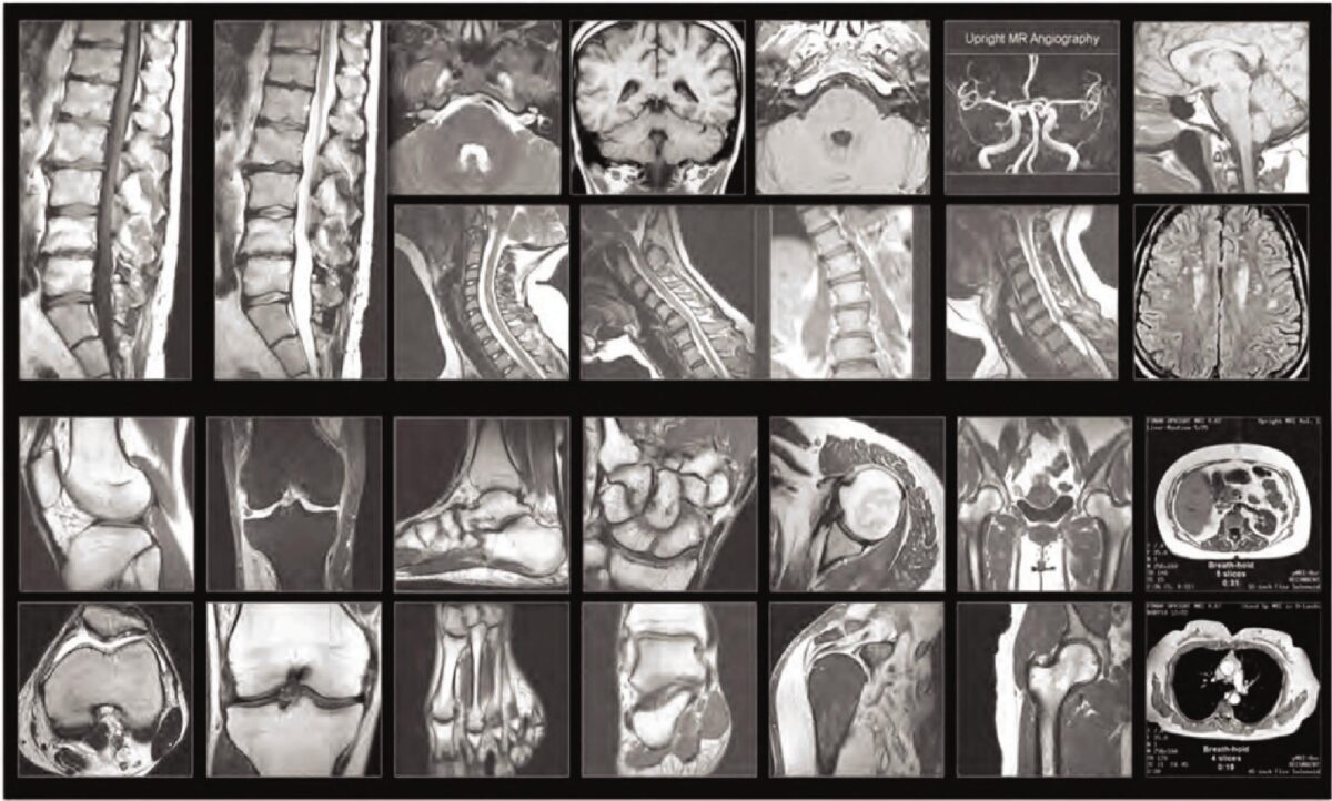 Misunderstanding field strength | Washington Open MRI