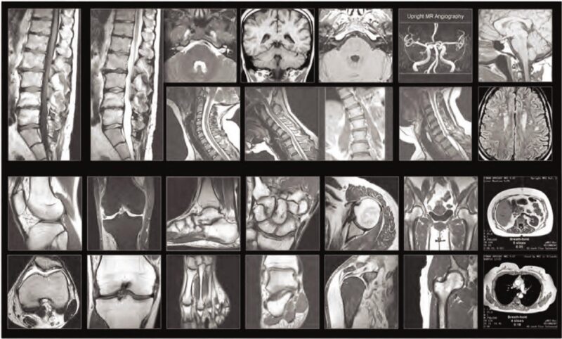 Misunderstanding field strength | Washington Open MRI