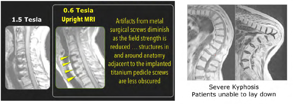 Misunderstanding field strength | Washington Open MRI
